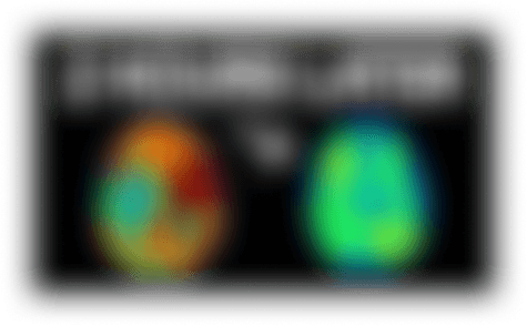 AI YouTube Thumbnail Analyzer - Test and Improve Thumbnails